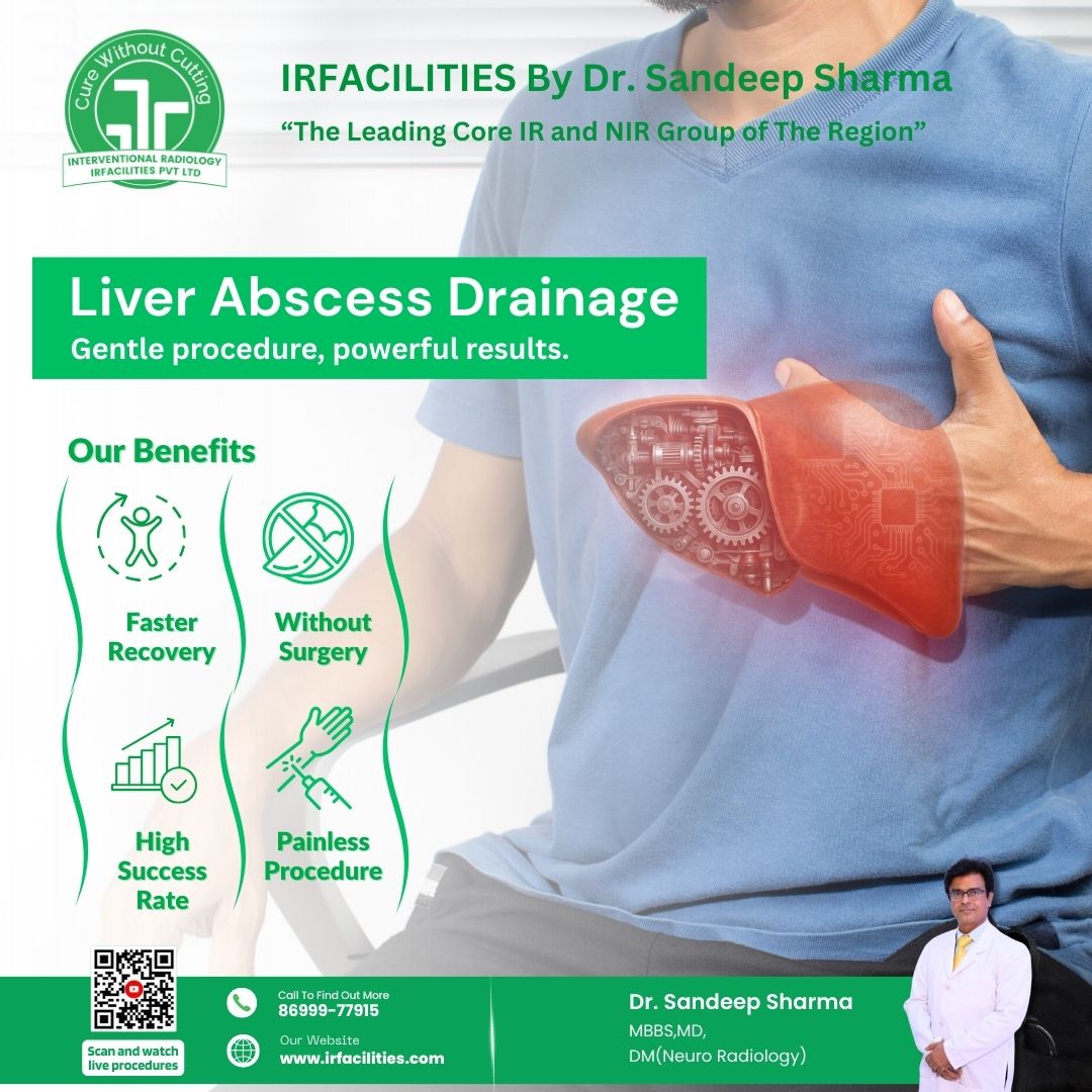 When Is a Liver Abscess Drainage Procedure Needed? - Get Listed UAE ...